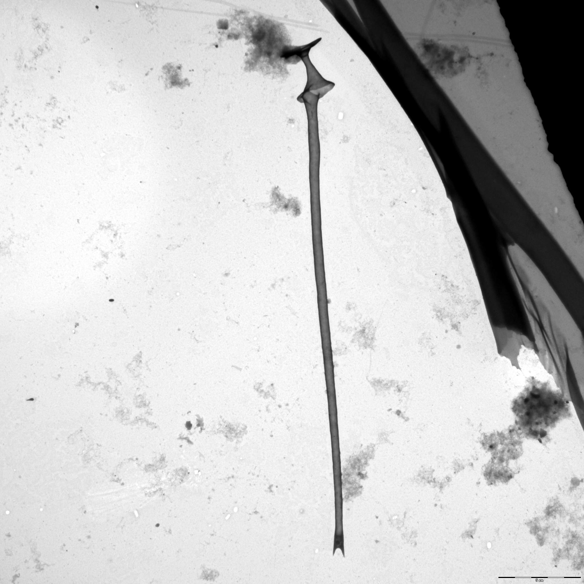 Chrysosphaerella longispina | Silica-scaled chrysophytes of Europe